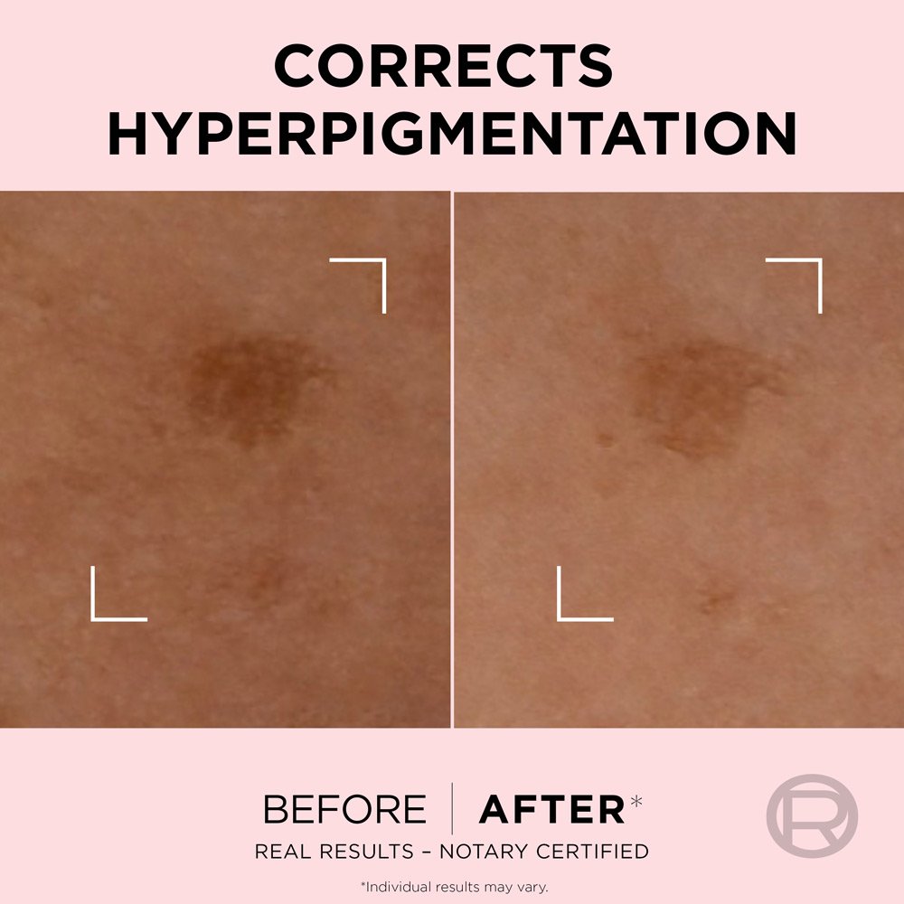 Golden Age Rapid Spot Corrector | Skincare | L'Oréal Paris