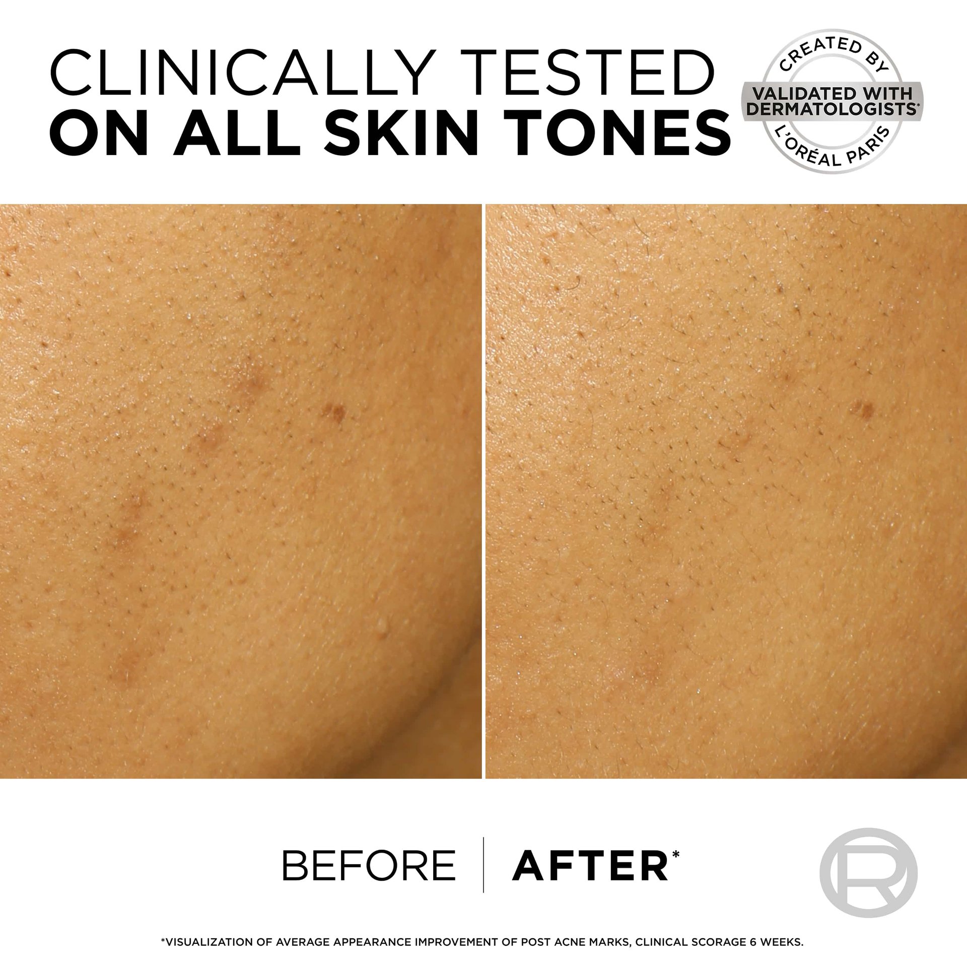 Dark Spot Exfoliating Snake Peel | Bright Reveal | L'Oréal Paris UK