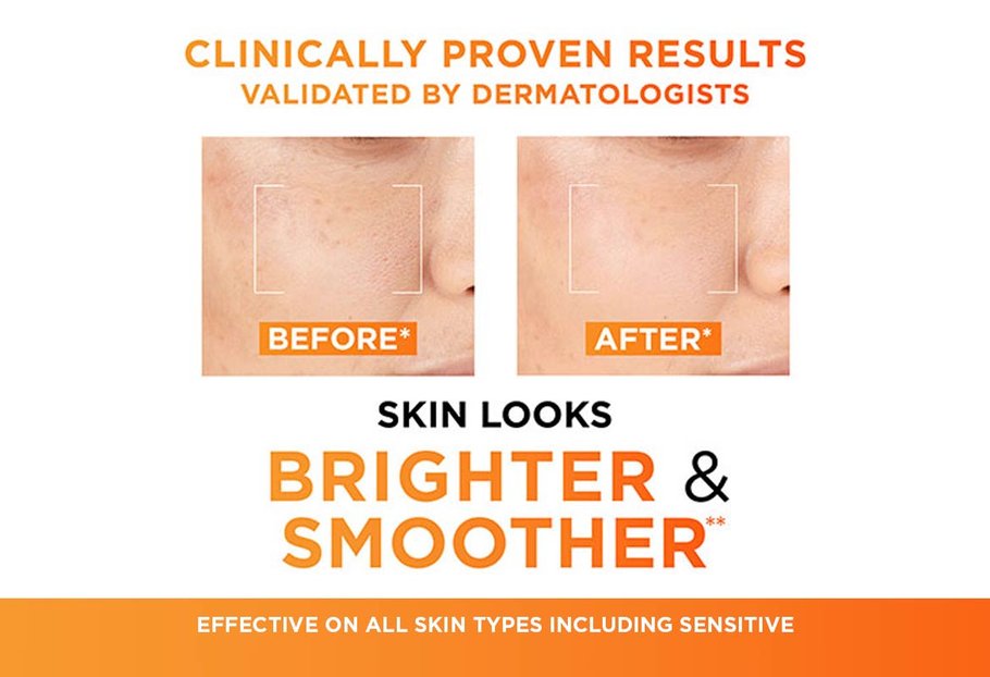 What is Vitamin C Good For? | Anti Ageing Skincare | L'Oréal Paris