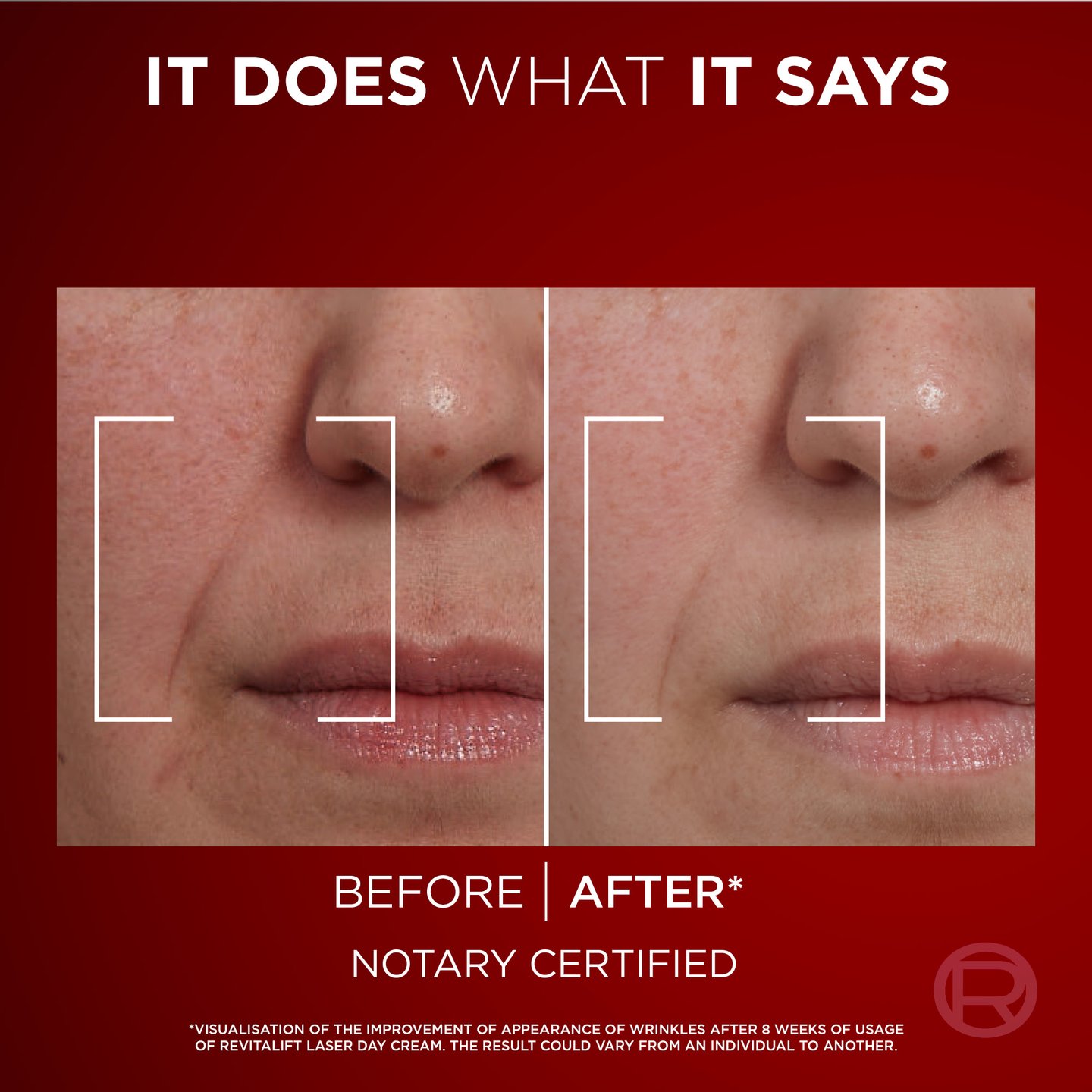 Revitalift Laser Day Cream | Anti-Aging Face Cream | L'Oréal Paris