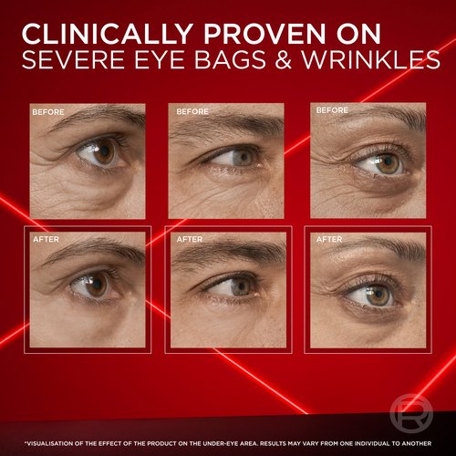 L'Oréal Paris Revitalift Laser Eye Bag Eraser | L’Oreal Paris Skincare.